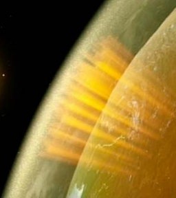 Treibhaus Erde | Unterricht - planet schule