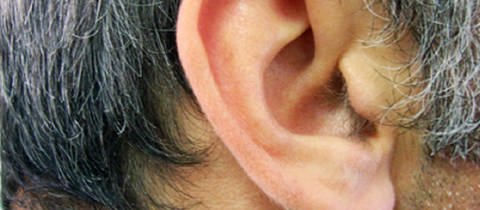 Biologie: Ohren gespitzt - wie funktioniert Hören? | Hintergrund ...